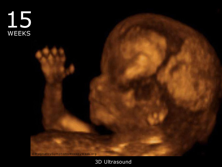 Fetus At 15 Weeks Ultrasound